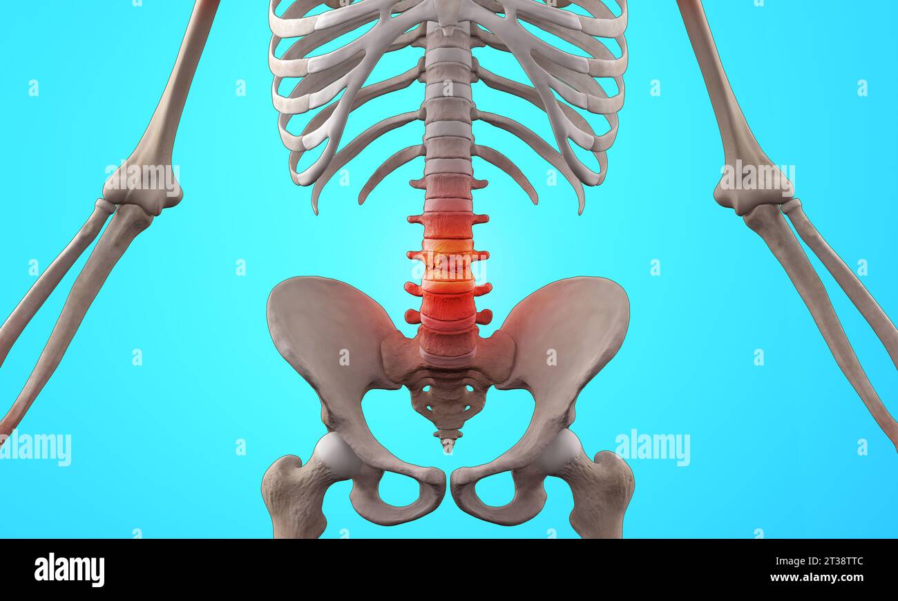 Anatomy of Human Spine. Lower back pain and human backache Stock Photo ...