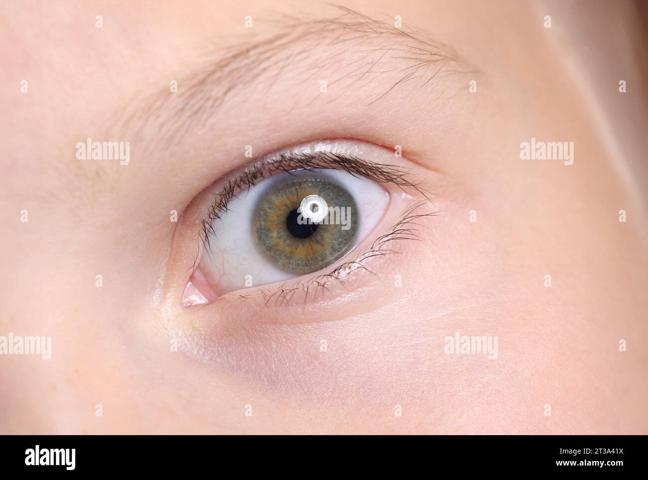 Wide open child's eye with an eyebrow and moles on skin Stock Photo - Alamy