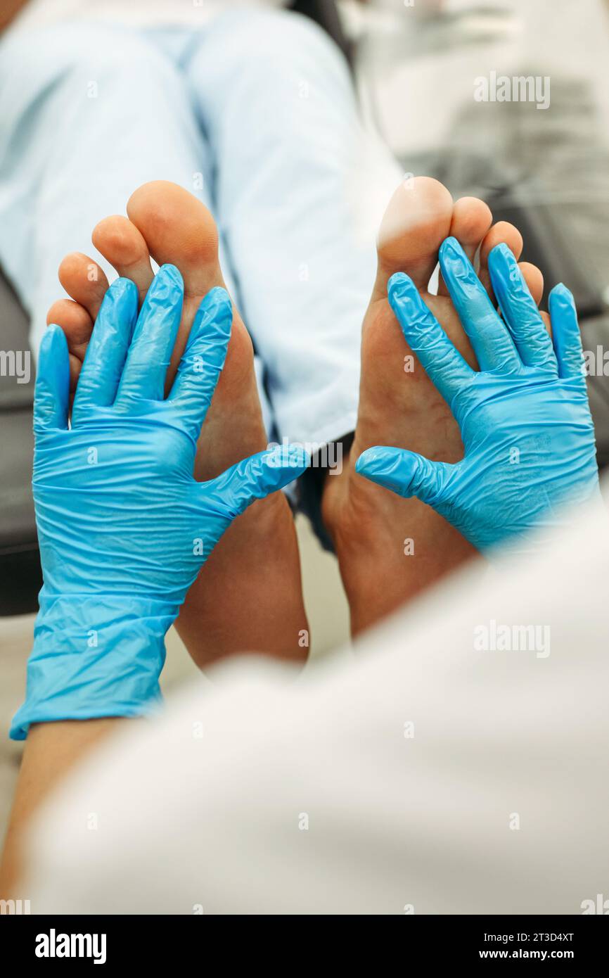 Foot treatment, massage. An orthopedic doctor does a foot massage after ...