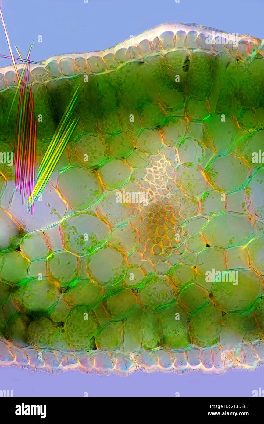 Hyacinth leaf with raphides, light micrograph Stock Photo - Alamy