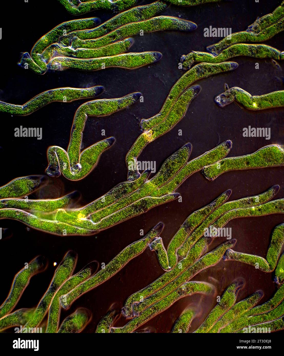 Ophrydium protozoa, light micrograph Stock Photo - Alamy
