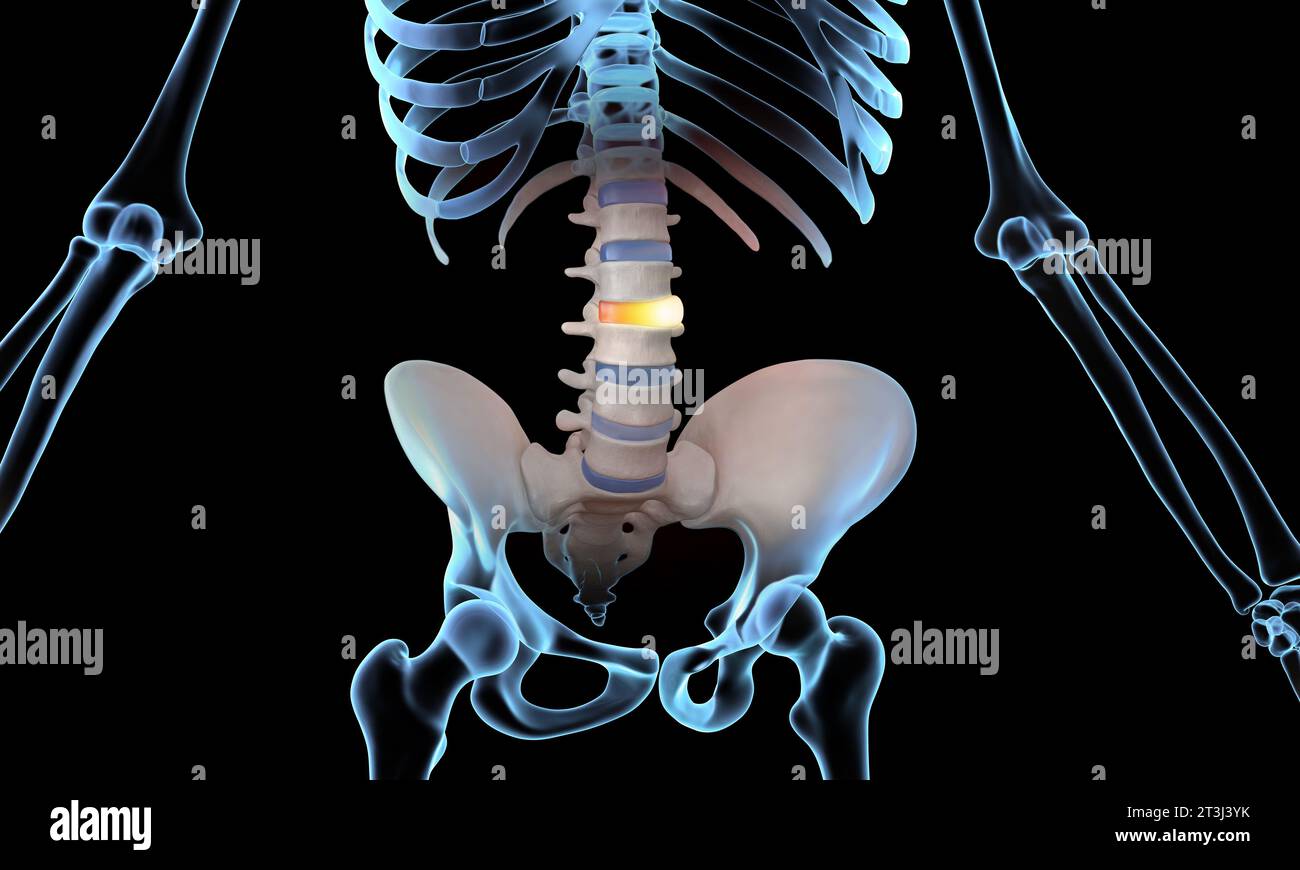 Anatomy of Human Spine. Lower back pain and human backache Stock Photo ...