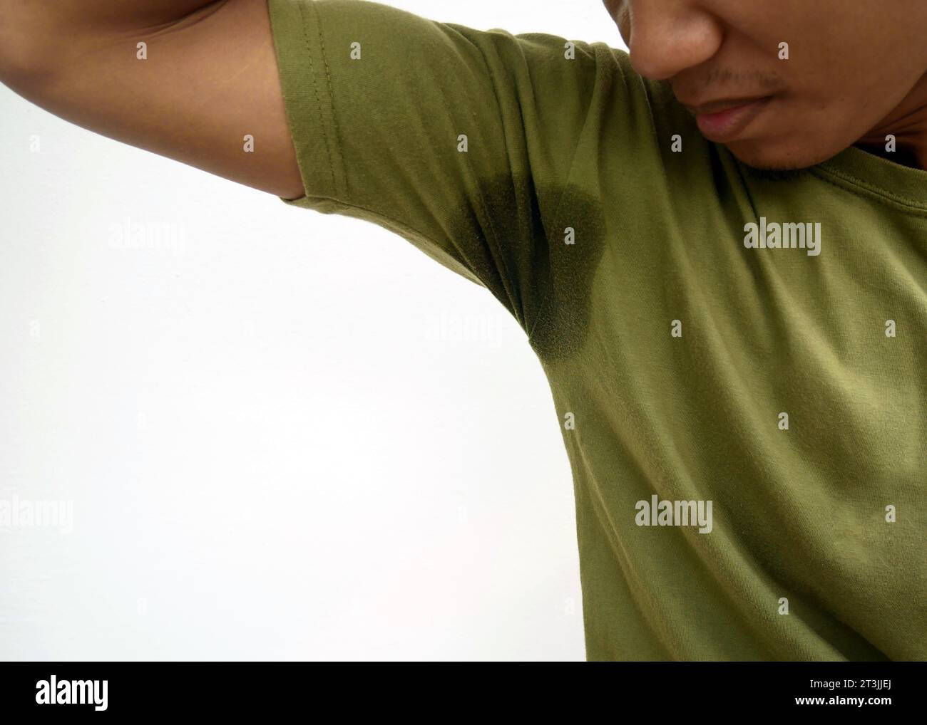 Man with unpleasant expression caused by hyperhidrosis sweat. Young ...