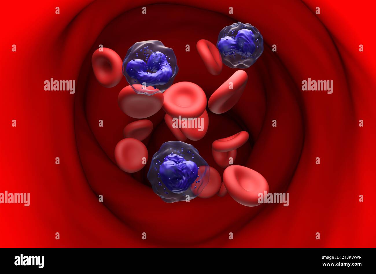 Chronic Myelogenous Leukemia (CML) cells in the blood flow - section ...