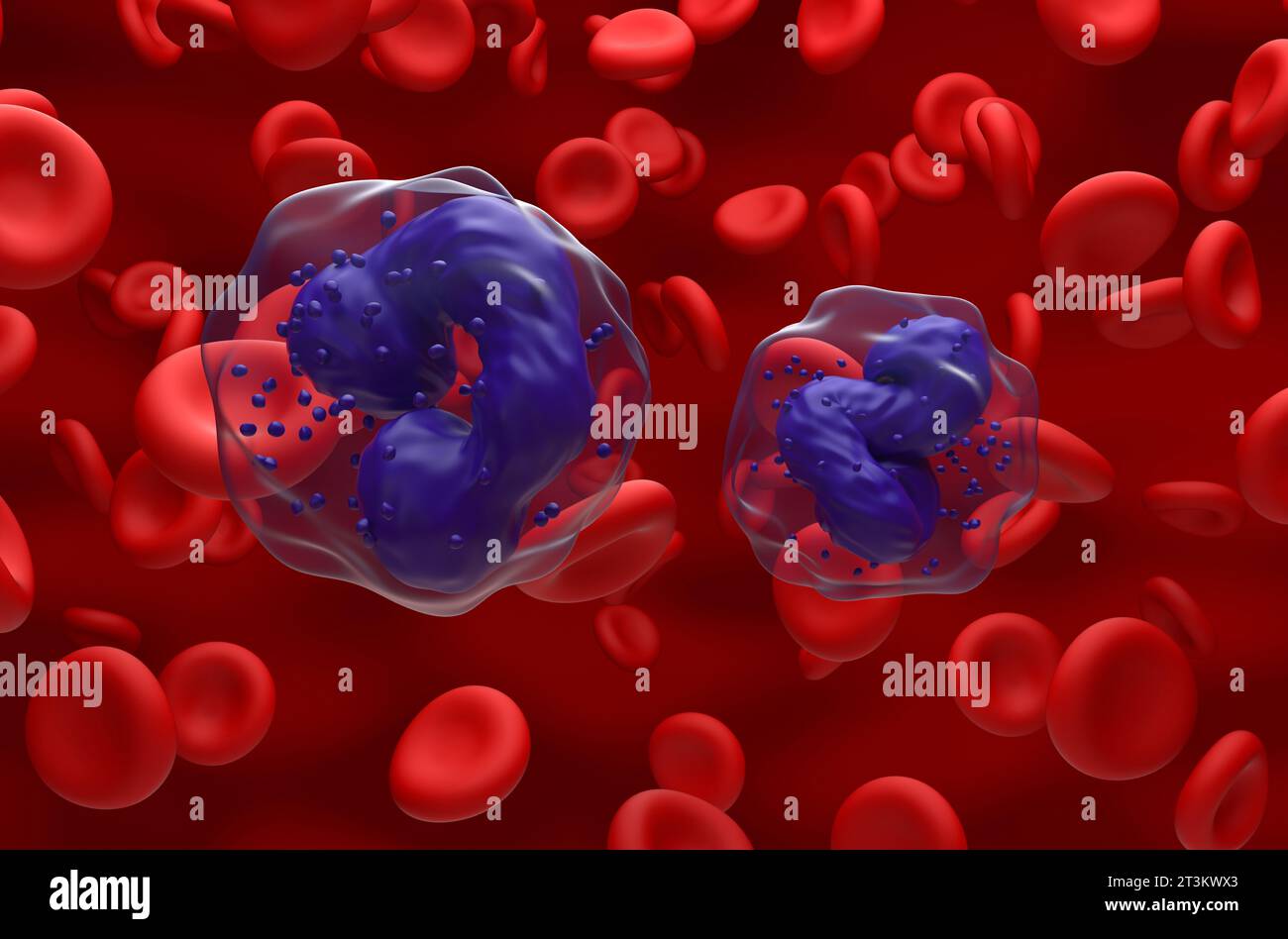 Chronic Myelogenous Leukemia (CML) cells in the blood flow - closeup ...
