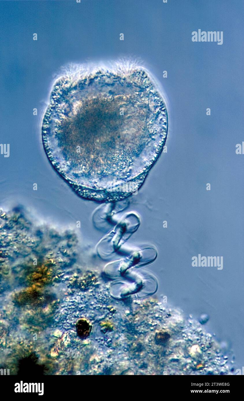 Vorticella (Ciliate) at 120x Stock Photo - Alamy