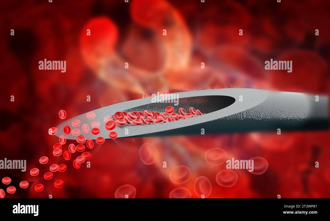 Blood on a needle on scientific background.3d render Stock Photo - Alamy