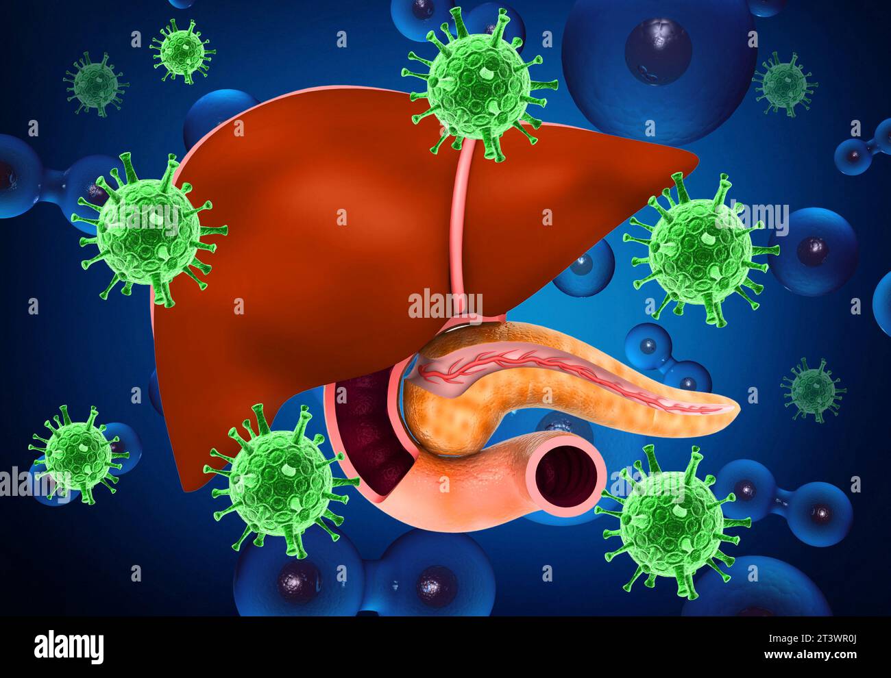Human liver with hepatitis viruses. 3d illustration Stock Photo - Alamy