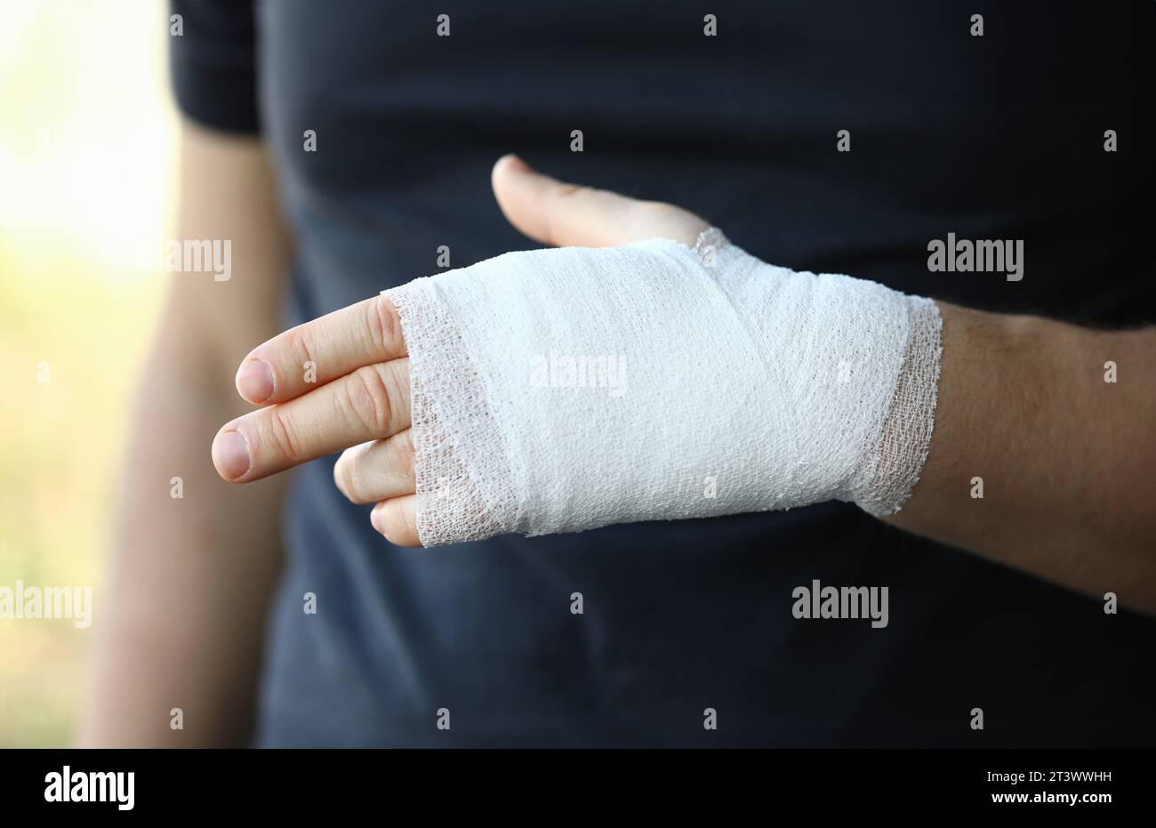 Male hand with tight elastic bandage on arm closeup Stock Photo - Alamy