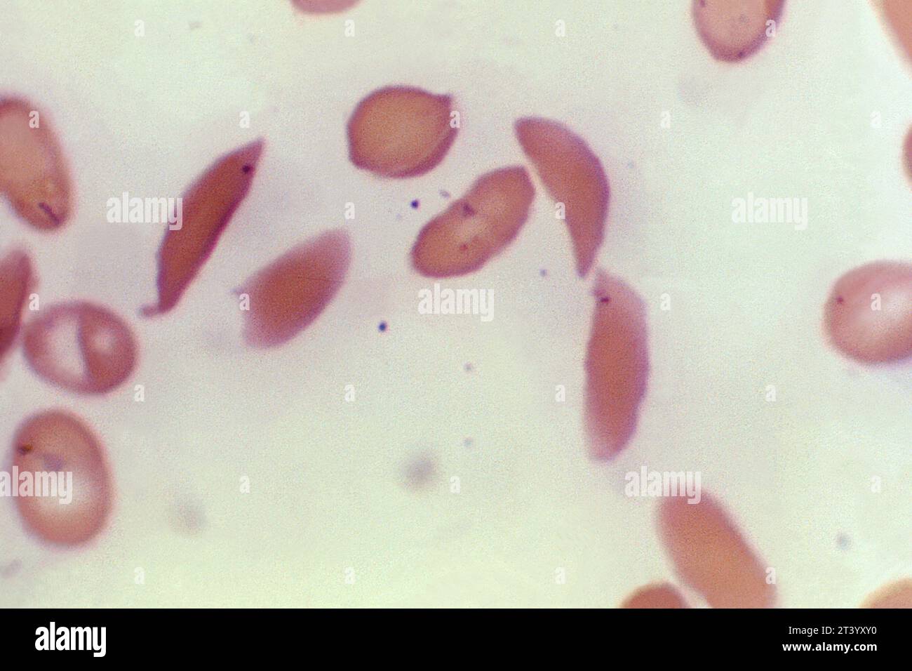 This microscope photo provided by the Centers for Disease Control and ...