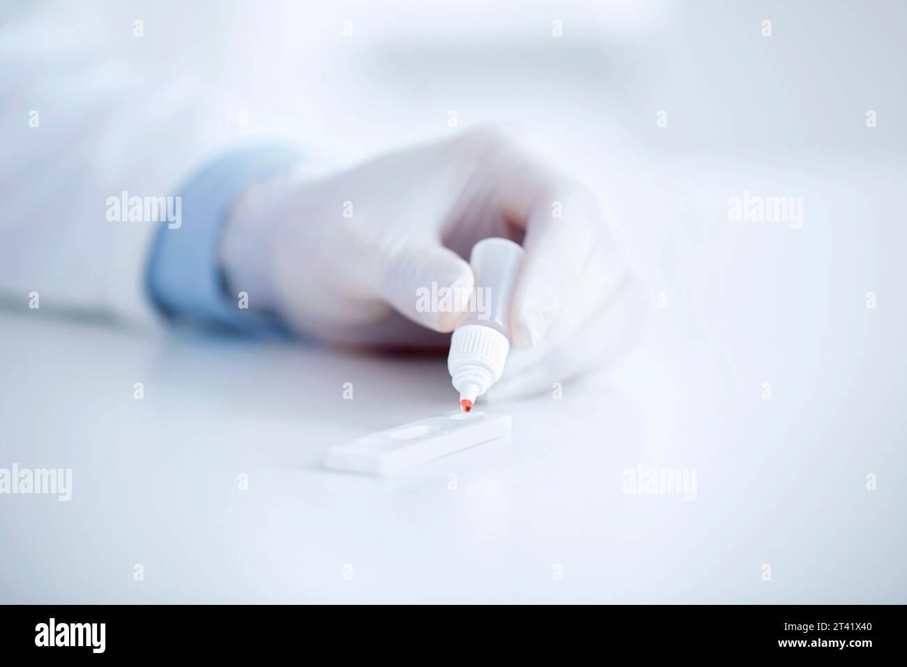 Capillary blood test Stock Photo - Alamy