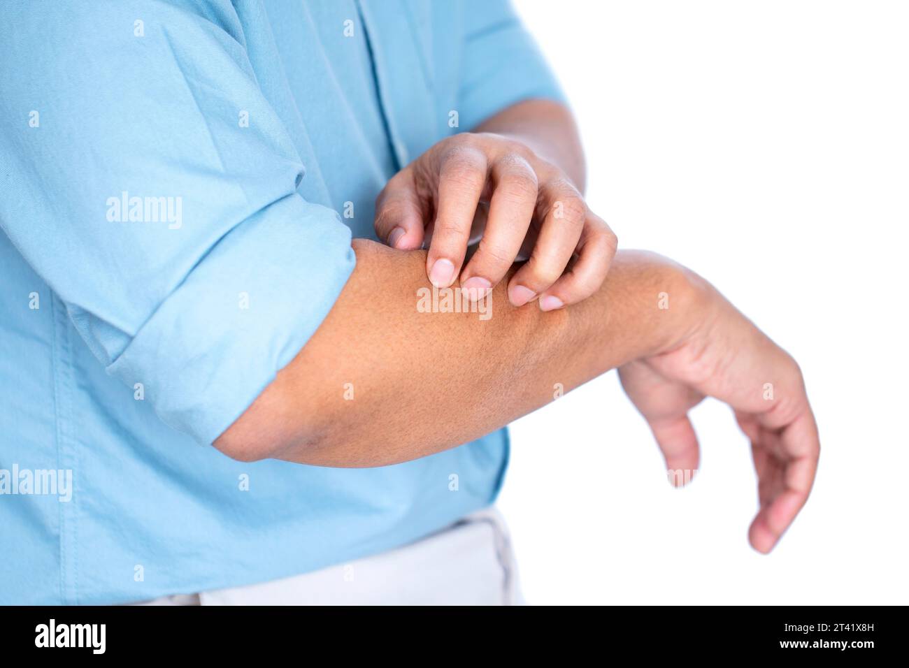 Man scratching his arm Stock Photo - Alamy