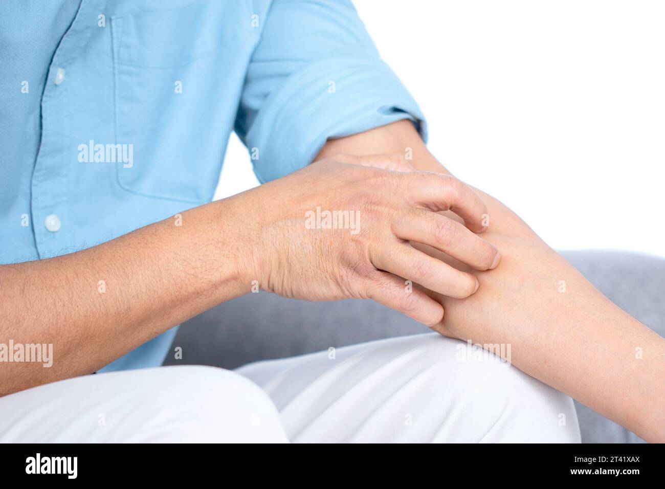 Man scratching arm hi-res stock photography and images - Alamy