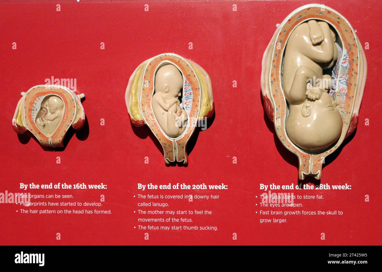 Three pregnant mothers with their unborn babies visible in the womb ...