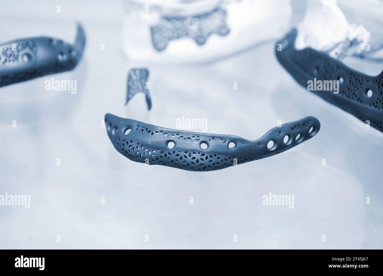 Facial bone of lower human jaw individual prosthesis printed on 3D ...