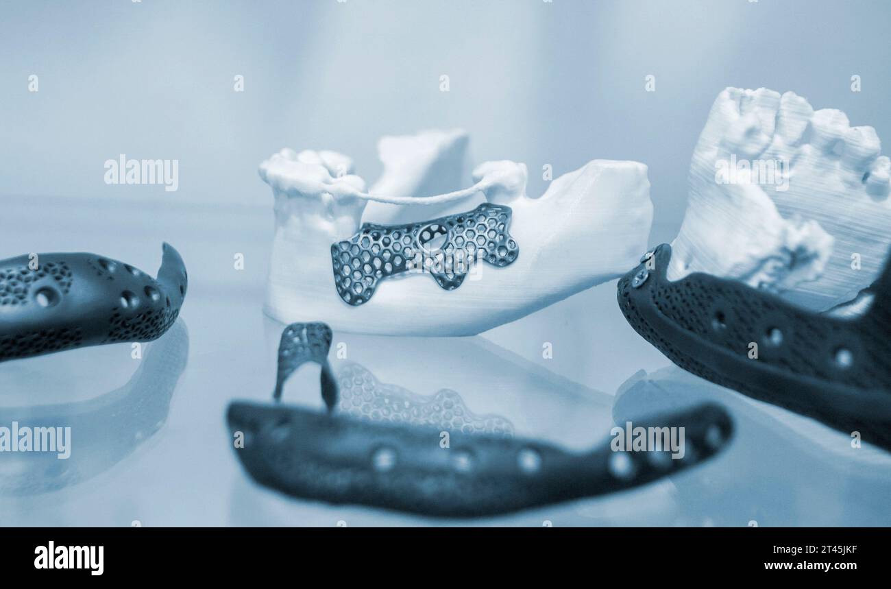 Facial bone of lower human jaw individual prosthesis printed on 3D ...