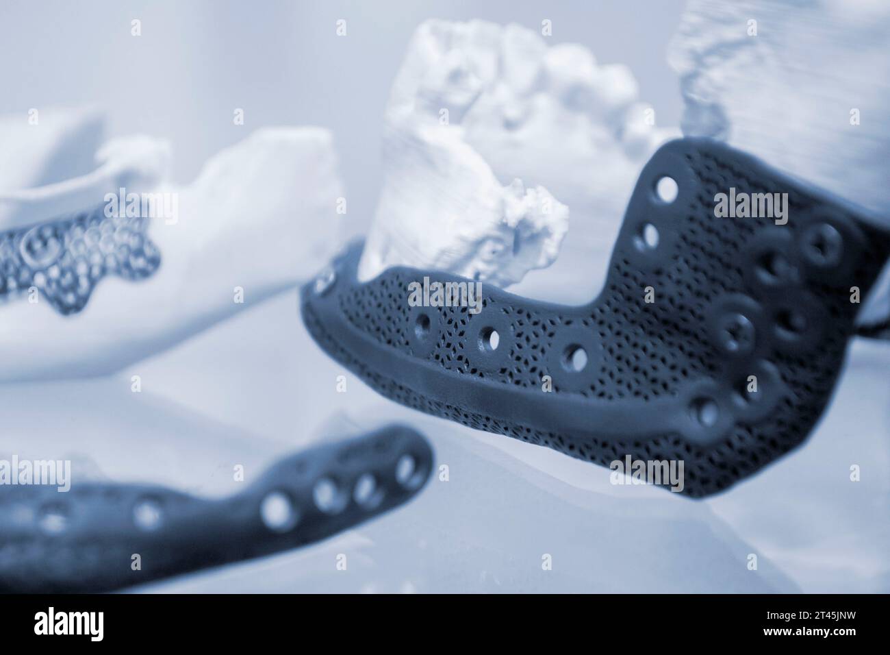 Facial bone of lower human jaw individual prosthesis printed on 3D ...