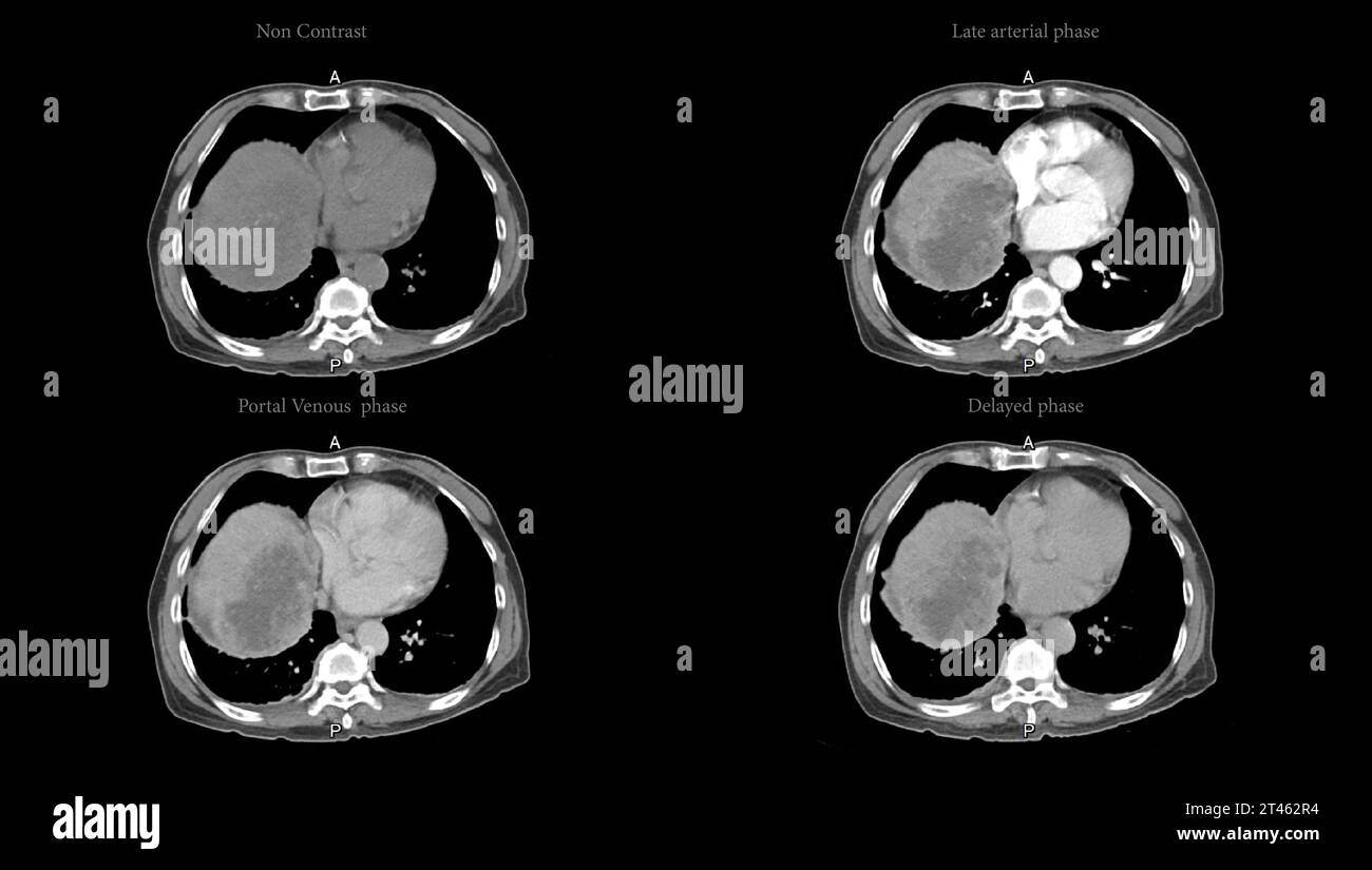 Dysesthesia Ddx at Maryann Diggs blog