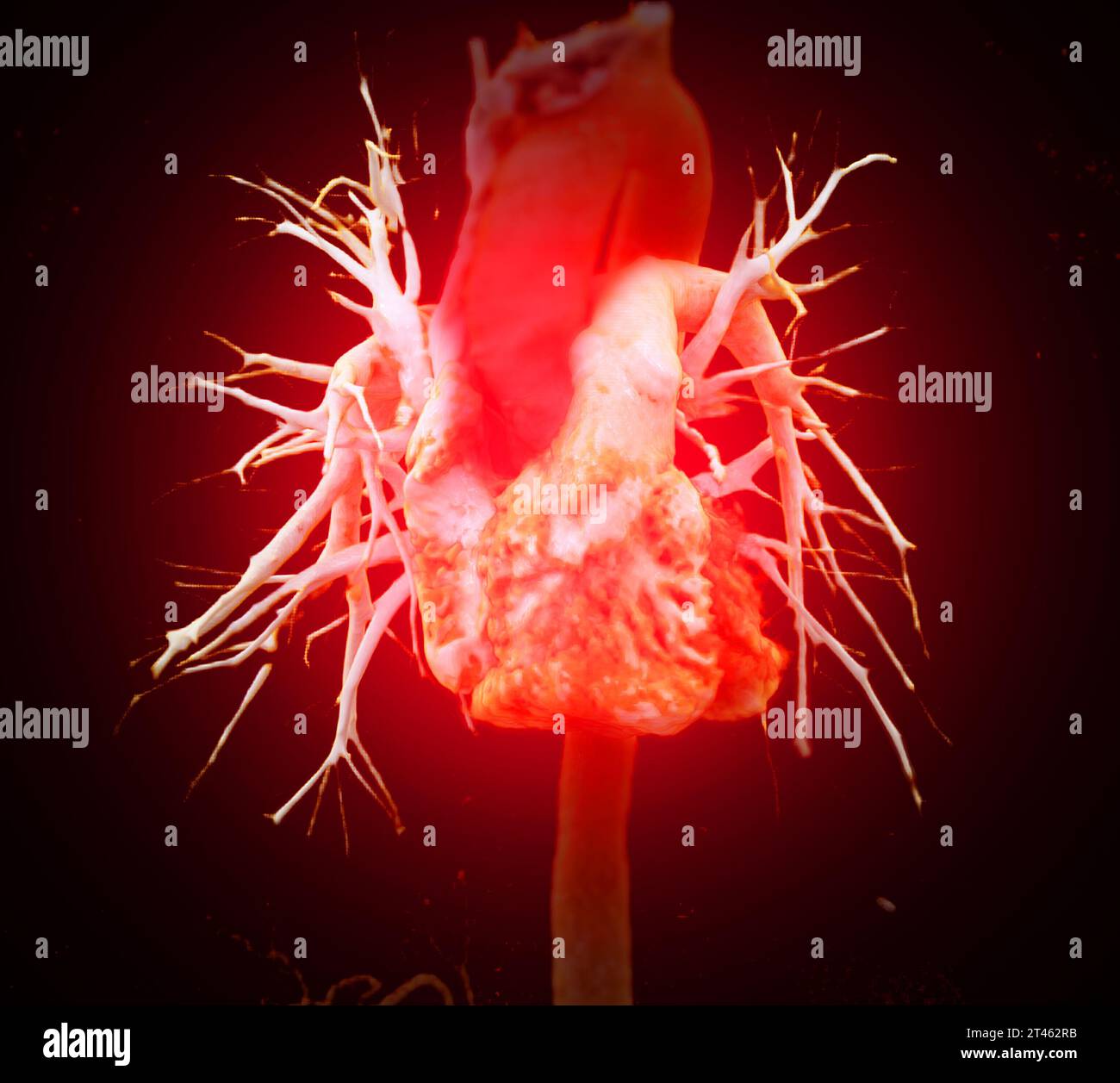 Normal heart artery hi-res stock photography and images - Alamy