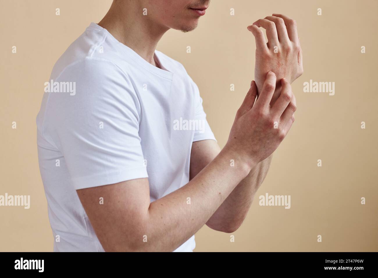 Side view closeup of unrecognizable man scratching hands suffering from ...