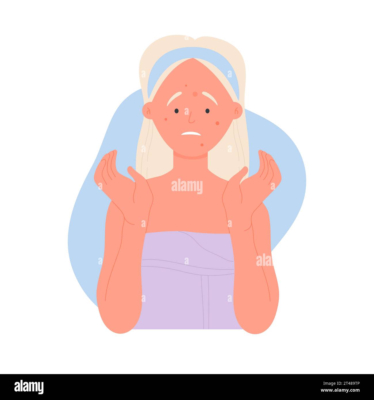 Upset girl with facial acne. Problematic face skin, blackheads and ...