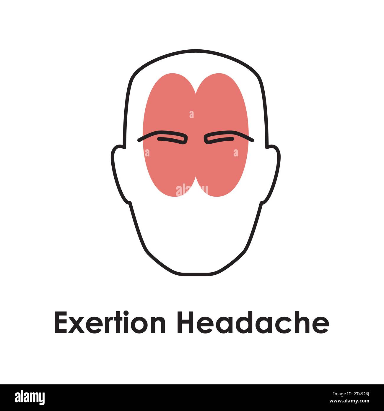 Exertion headache color icon. Vector isolated illustration. Migraine ...