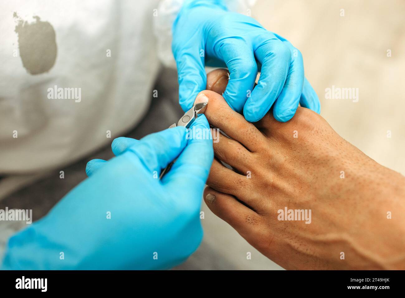 orthopedic doctor in blue gloves treats legs, close-up, treats feet ...