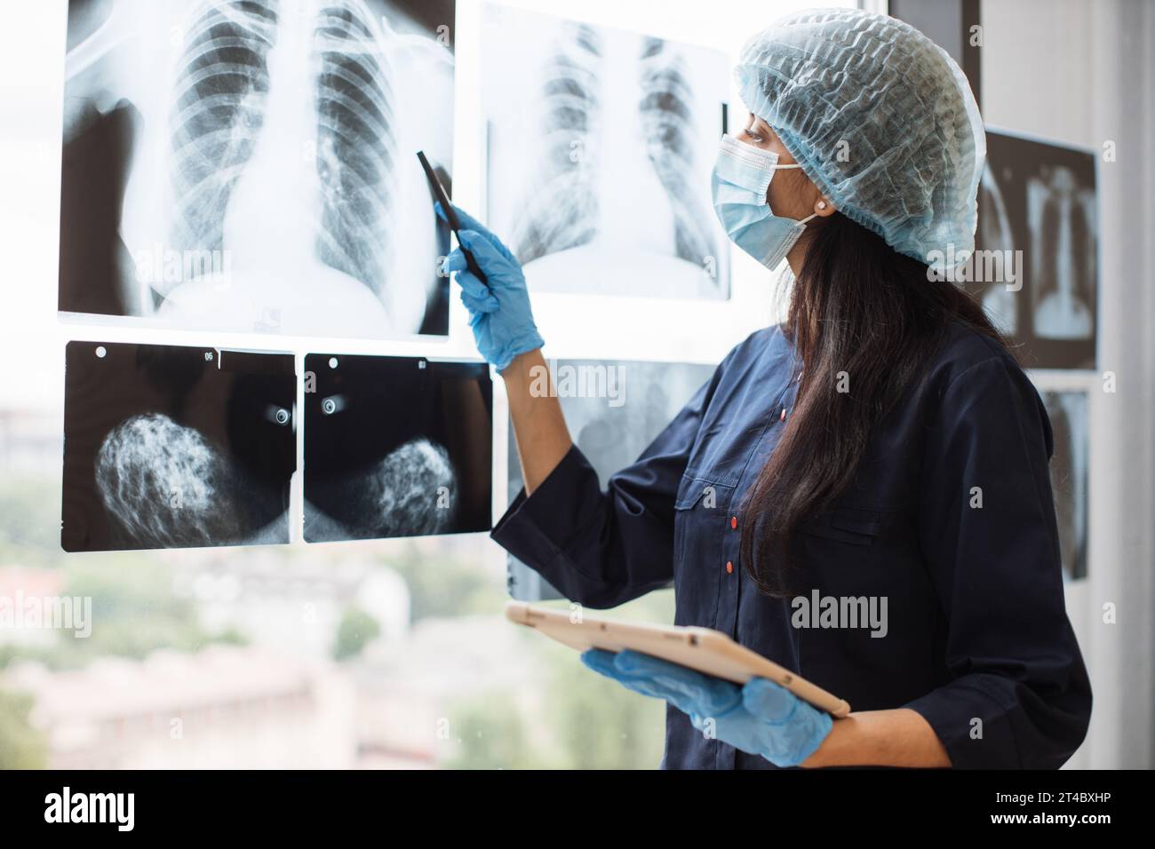 Female worker posing with digital tablet near x-ray scans Stock Photo ...