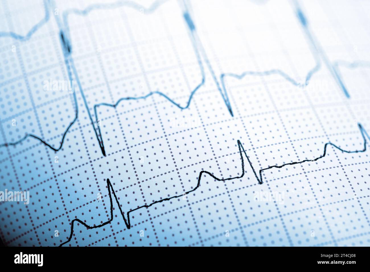 Electrocardiogram showing the pulse of the human heart Stock Photo - Alamy