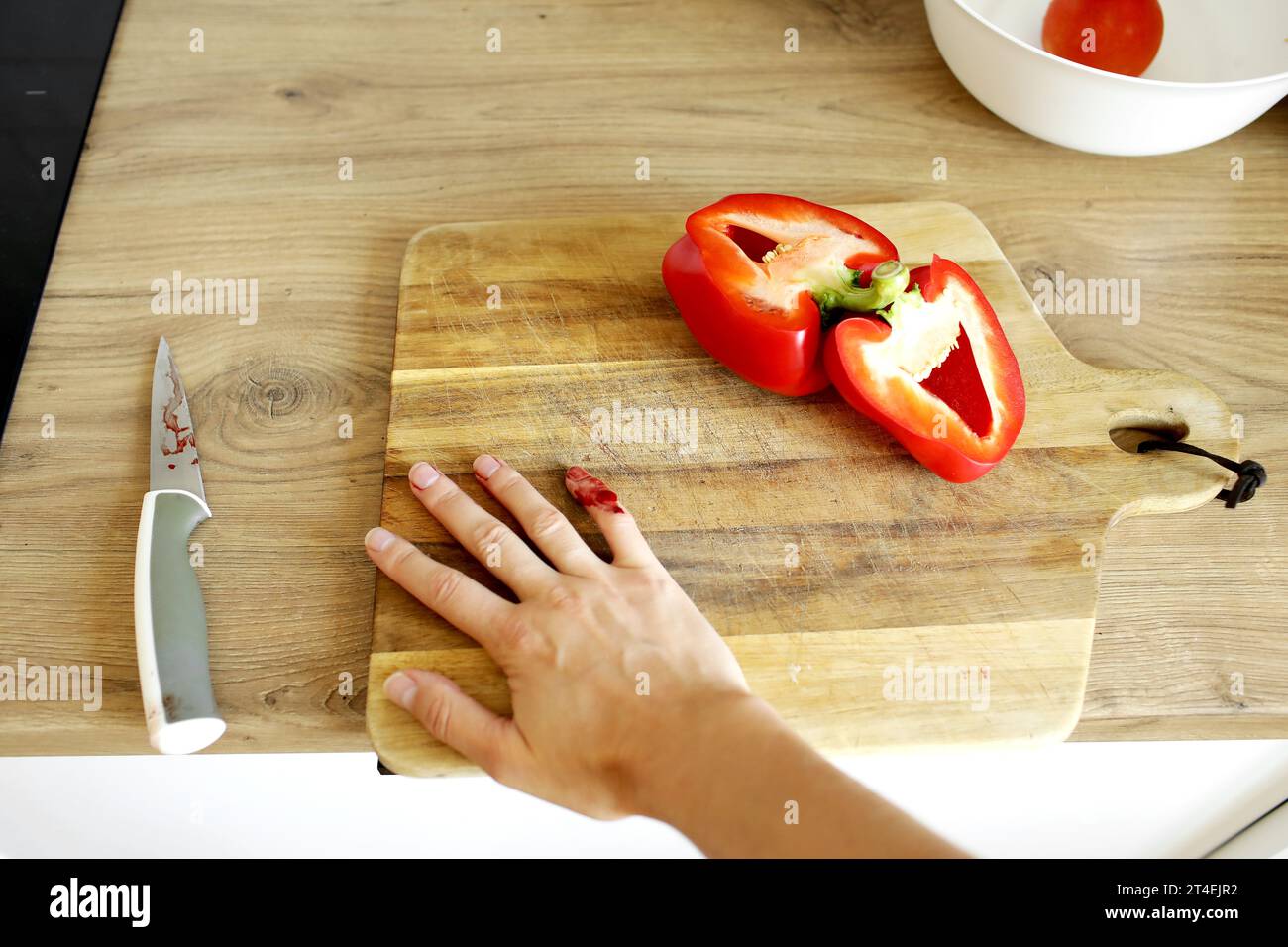 Female hand with blood. Woman wounded her little finger with knife ...