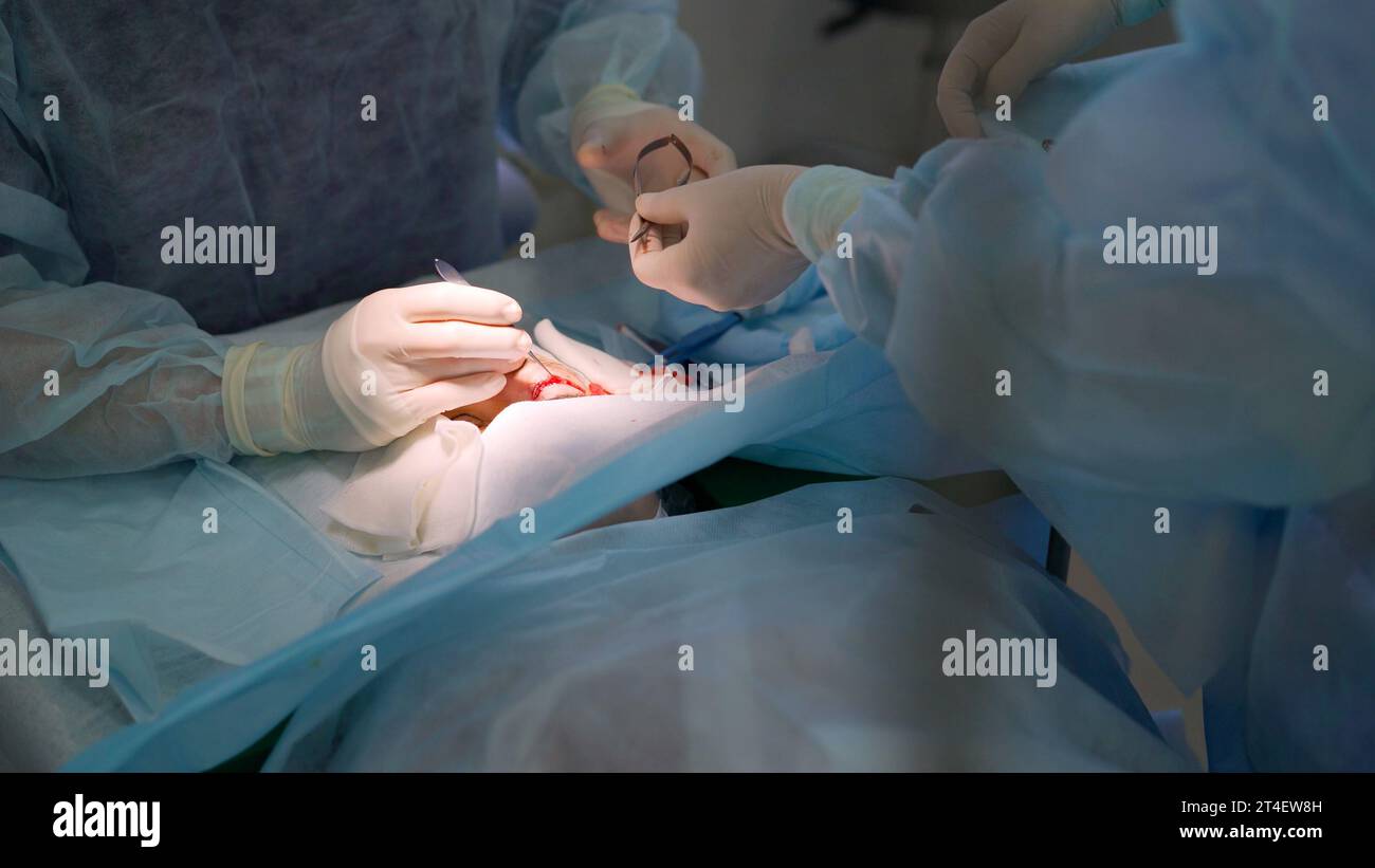 Person performs eye surgery clinic hi-res stock photography and images ...