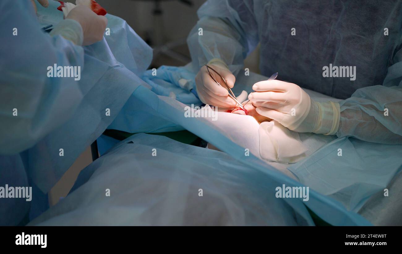 Close up the surgeon removes fat from the patient eyelid with special ...