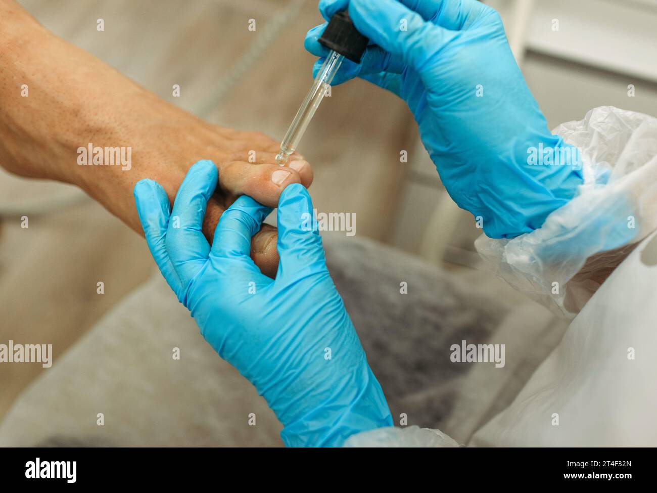 A doctor drops medicine from a pipette onto a sore finger. Close-up of ...