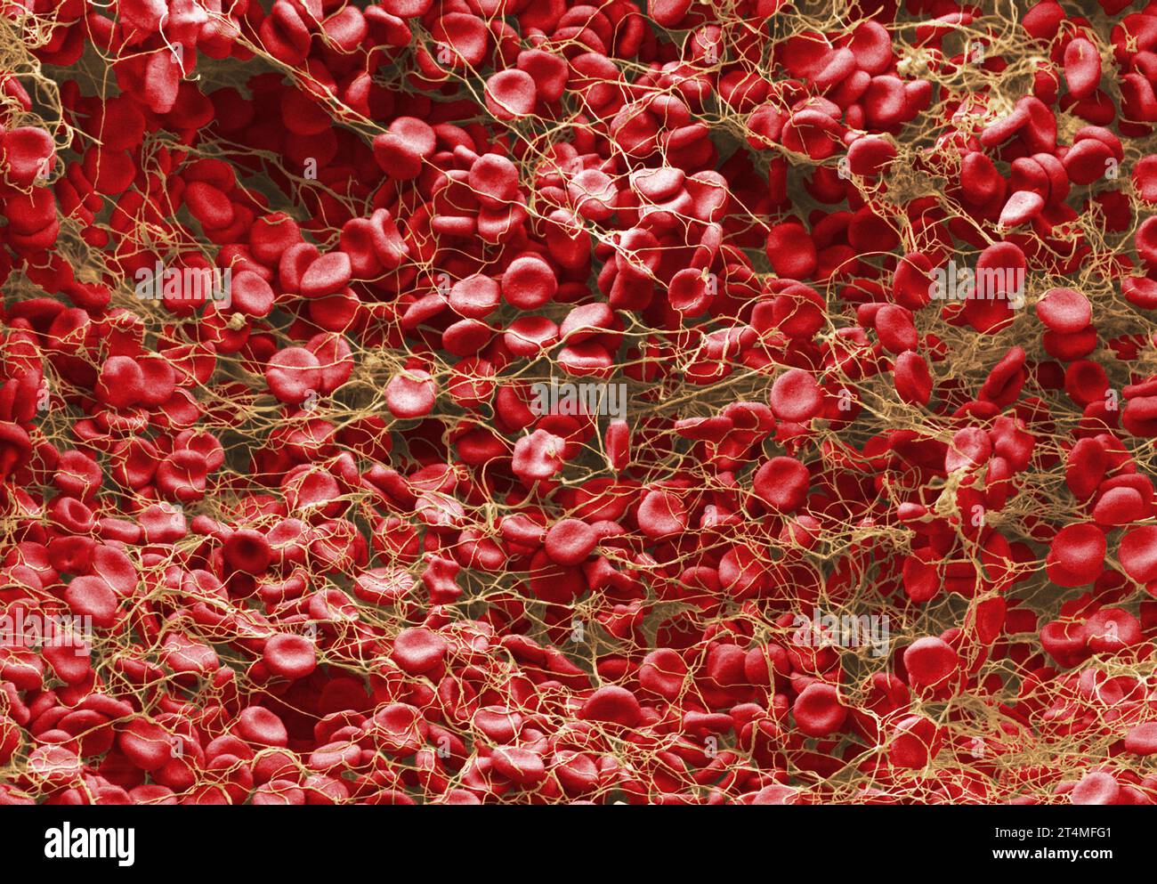 Red blood cells forming clot, SEM Stock Photo - Alamy