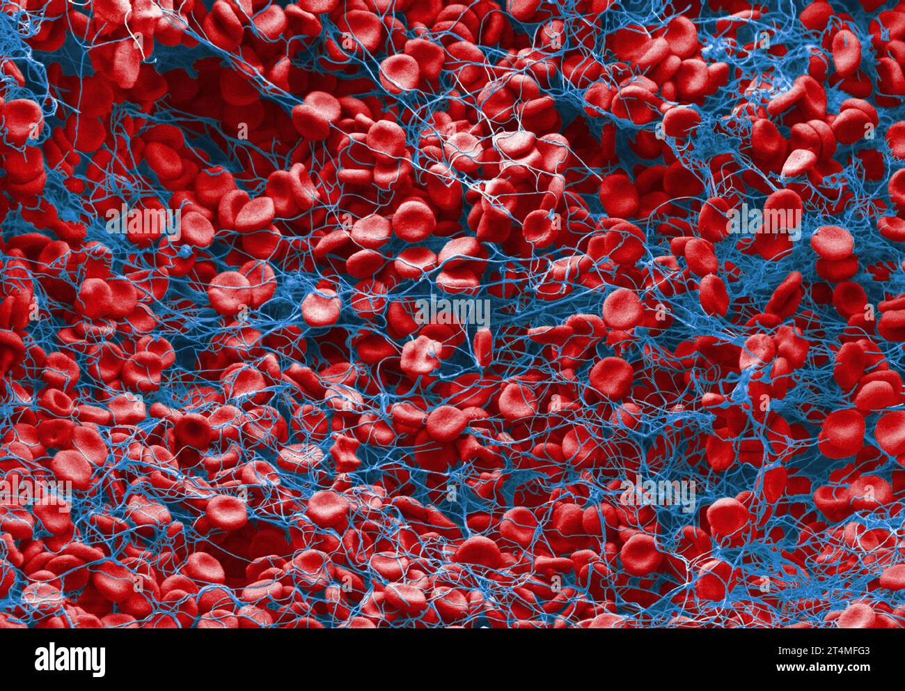 Red blood cells forming clot, SEM Stock Photo - Alamy
