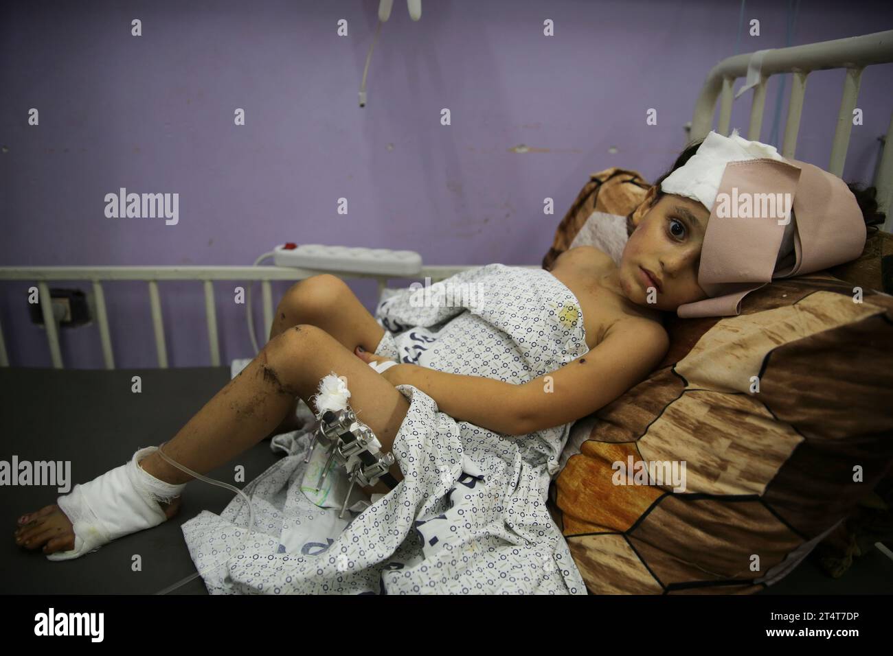 Kenzi al Madhoun, a four-year-old who was wounded in Israeli ...