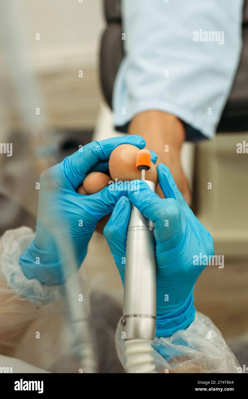 orthopedic doctor in blue gloves doing treatment of legs, close-up ...