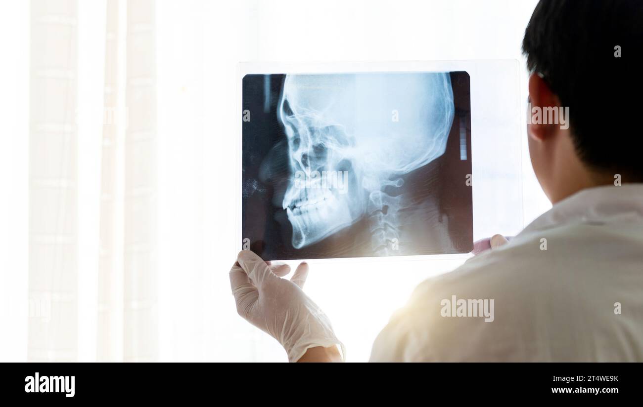 Doctor holding X-ray picture of head Stock Photo - Alamy