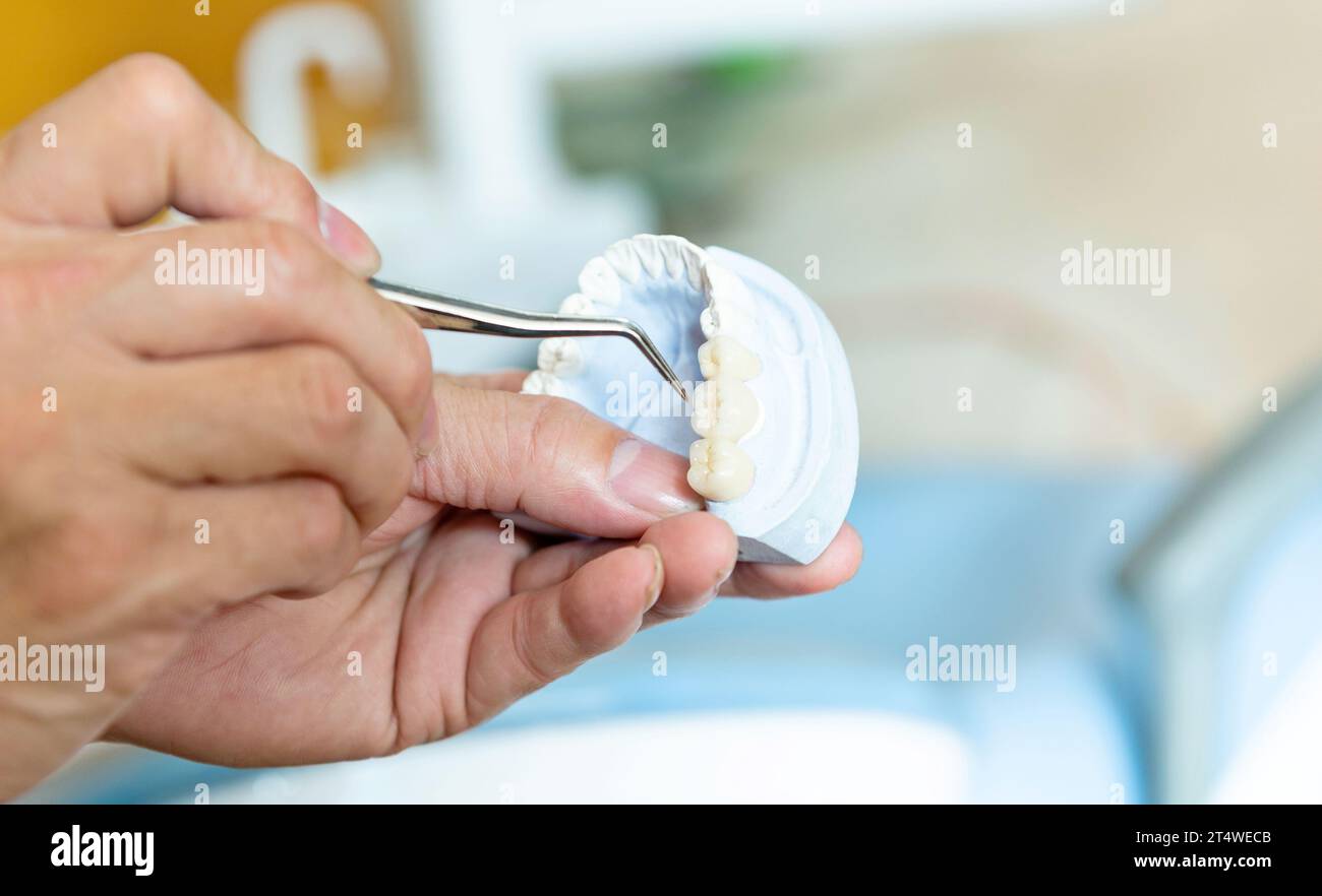 Dentist showing ceramic dental cast in clinic Stock Photo - Alamy