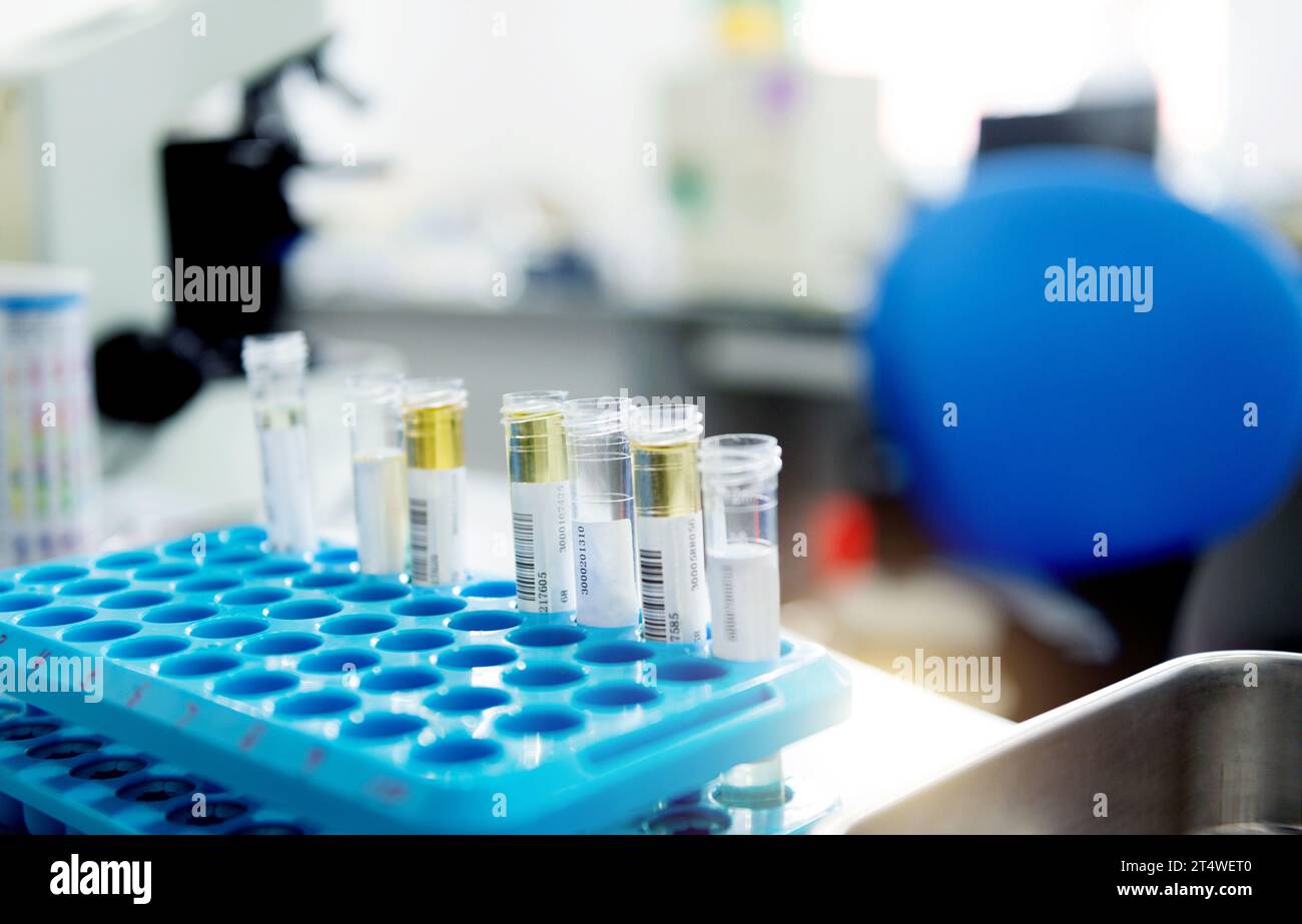Rack with group of tubes and laboratory microscope Stock Photo - Alamy