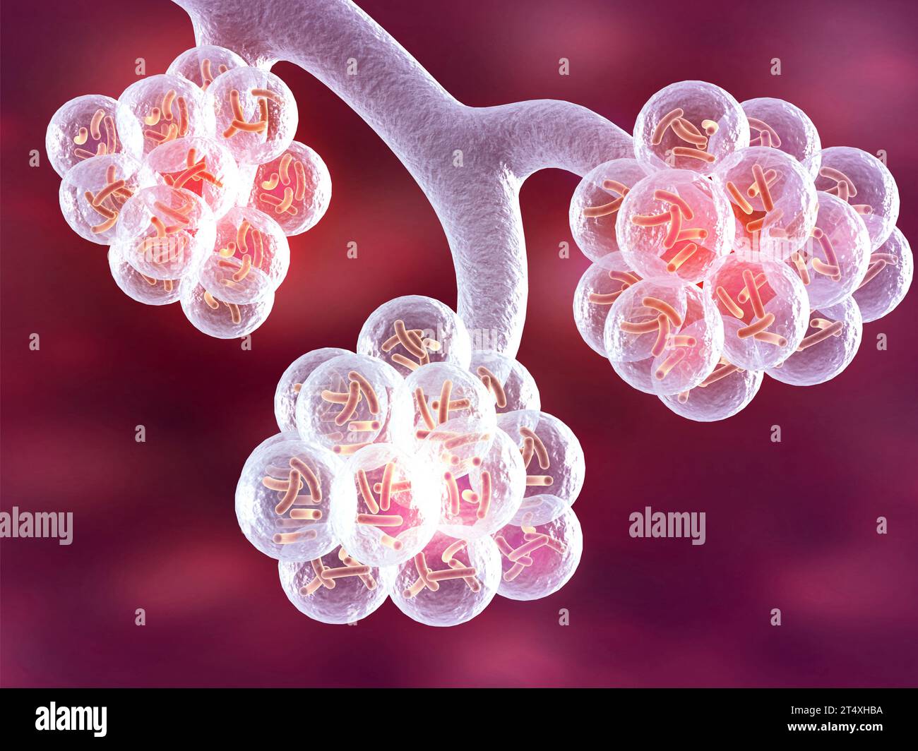 Illustration human alveoli alveoli hi-res stock photography and images ...