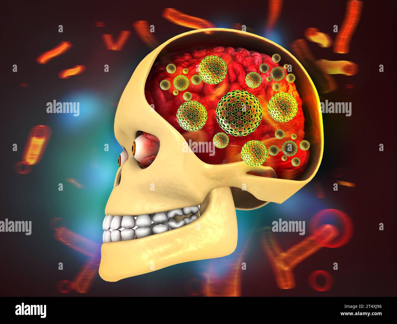 Virus attacking humans brain. 3d illustration Stock Photo - Alamy
