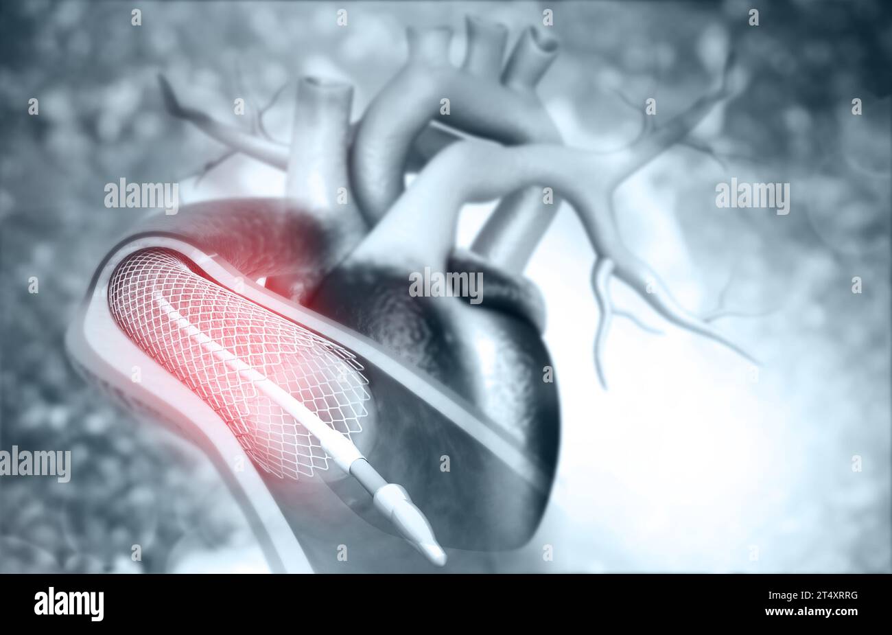 3d human body fat heart hi-res stock photography and images - Alamy