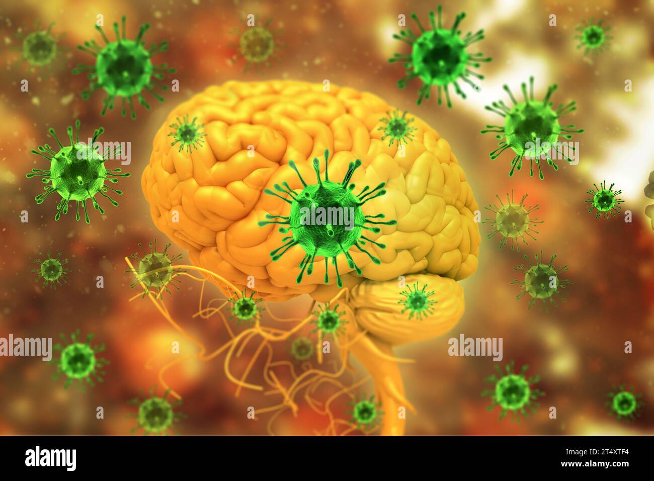 Virus infection on brain. 3d illustration Stock Photo - Alamy