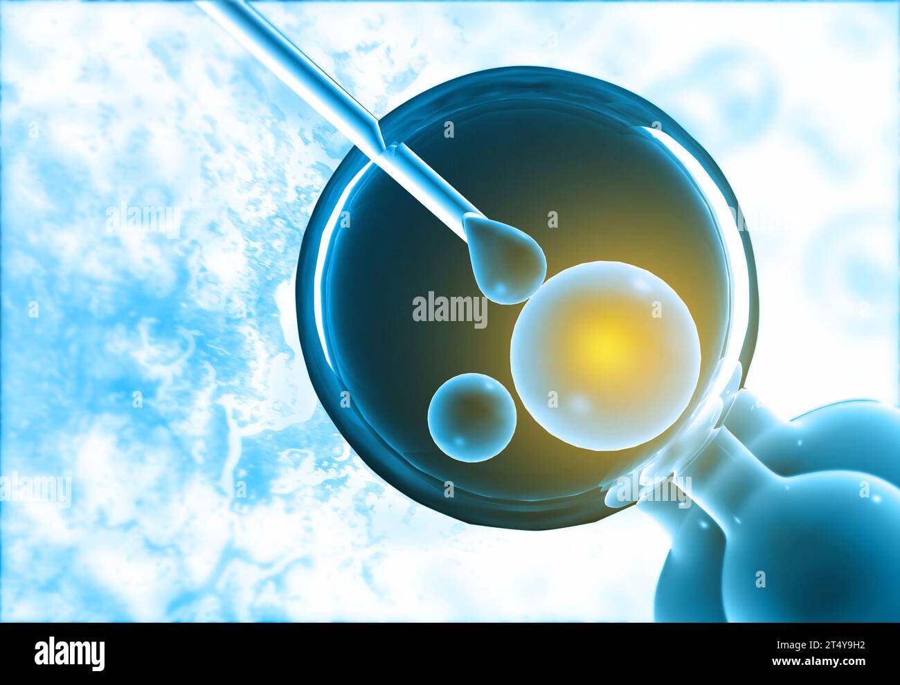vitro fertilization. medical background. 3d illustration vitro ...