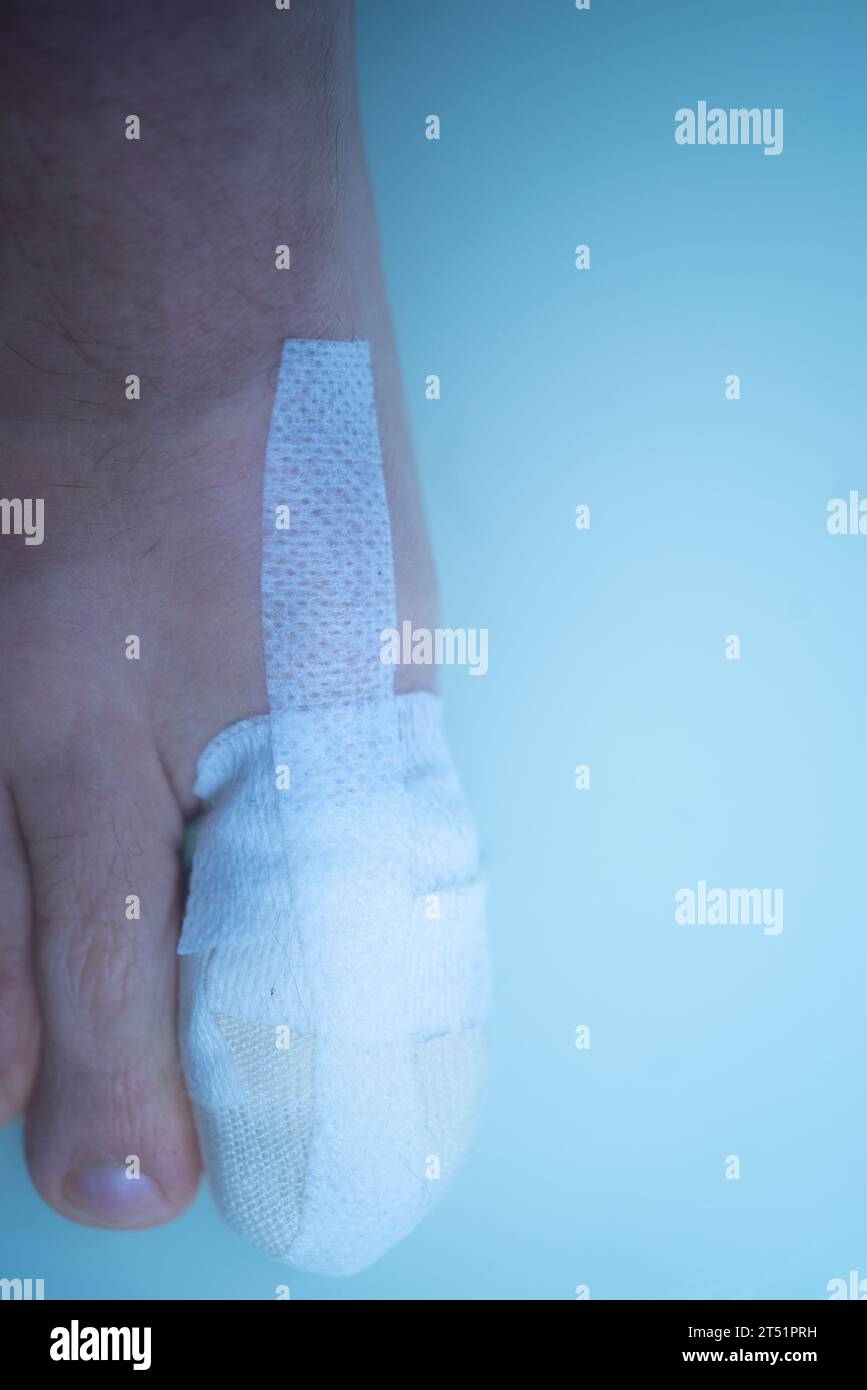 Foot big toe bandage injured feet in medical clinic hospital center ...