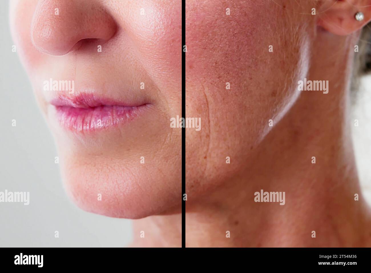 Before and After: Woman Lifts Face for Skin Transformation Stock Photo ...