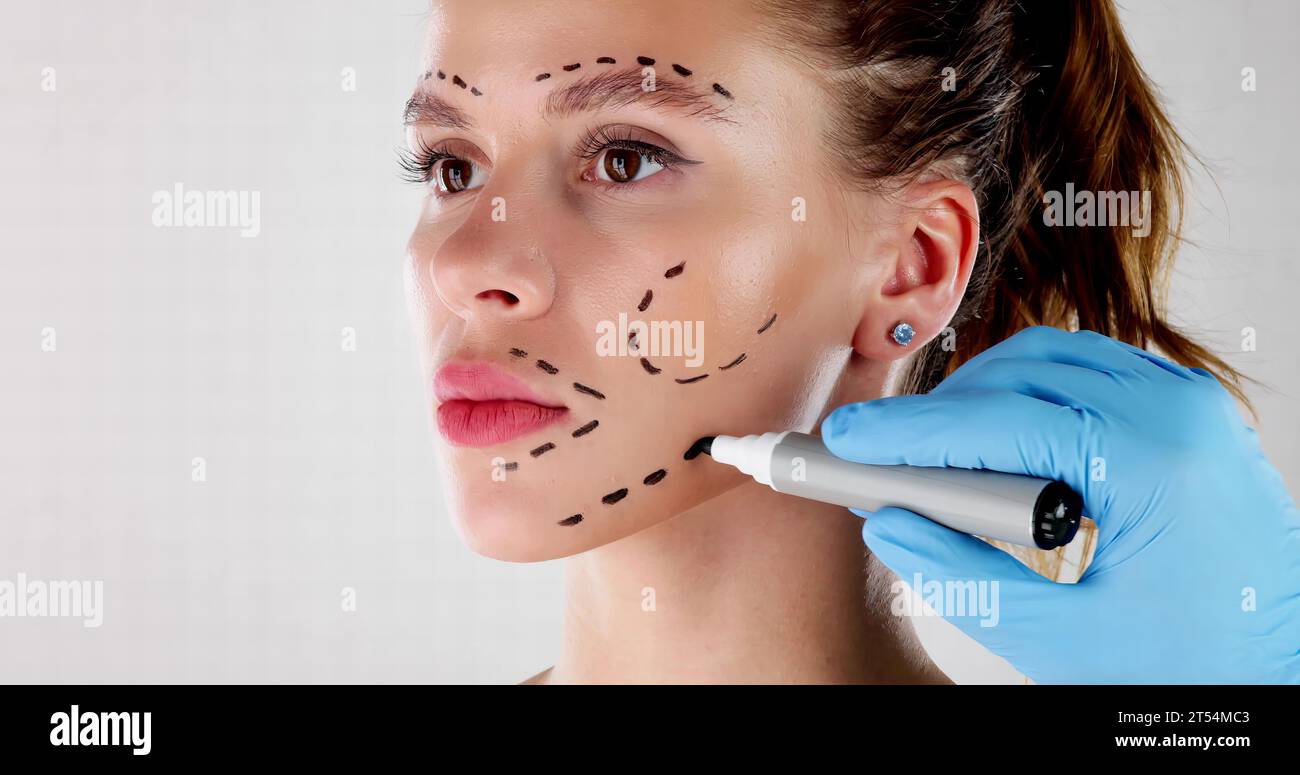 Facial Aesthetics Facelift. Plastic Surgery Drawings On Face Stock ...