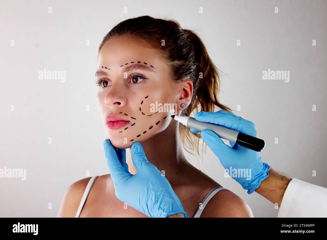 Facial Aesthetics Facelift. Plastic Surgery Drawings On Face Stock ...