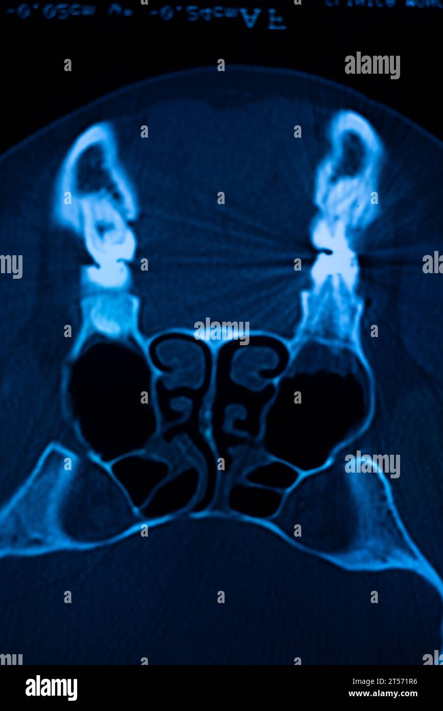 Xray scan skull nose medical exam results from hospital clinic Stock ...